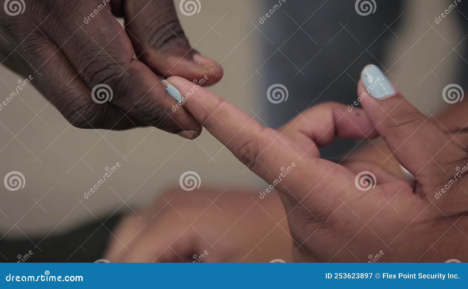 Staff Training To Give First Aid To Arm with Broken Bones Stock Video ...