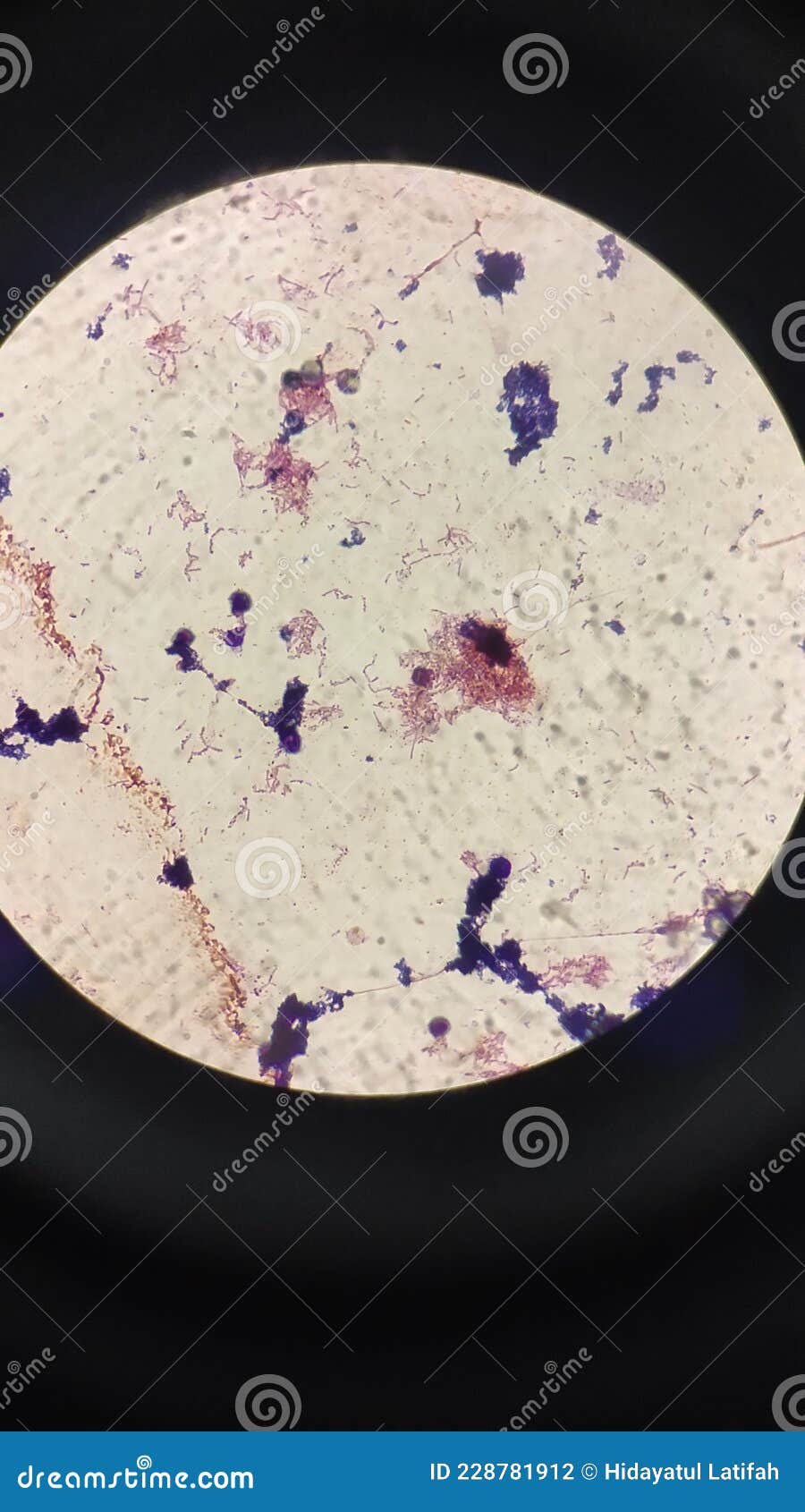 Stained Bacteria Seen through a Microscope Stock Photo - Image of ...