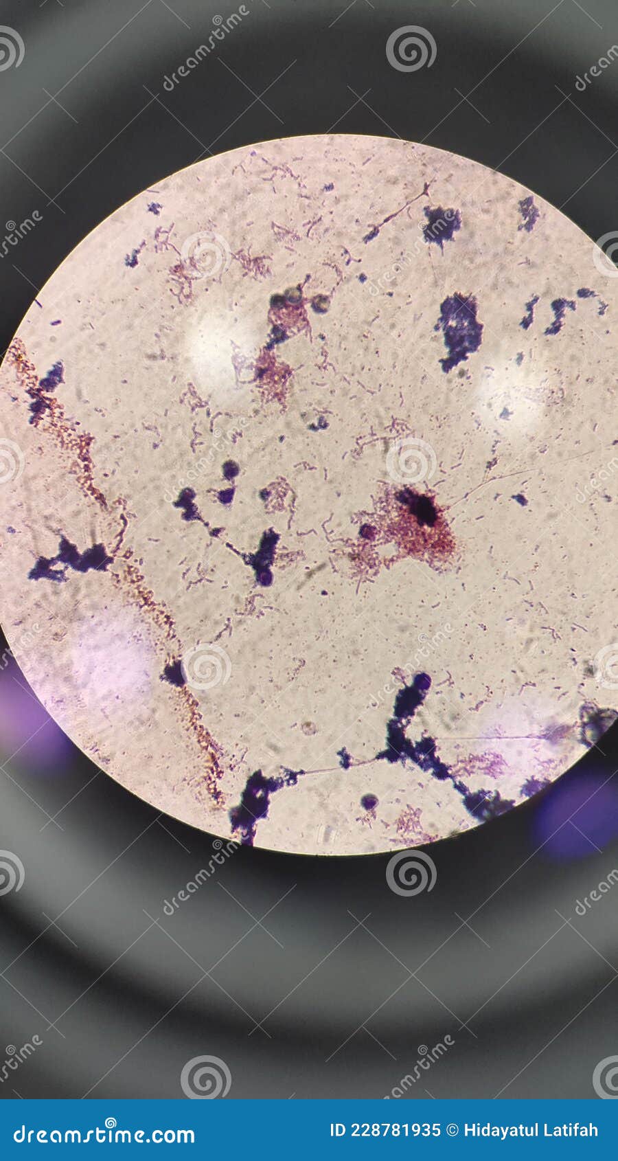 Stained Bacteria Seen through a Microscope Stock Image - Image of ...