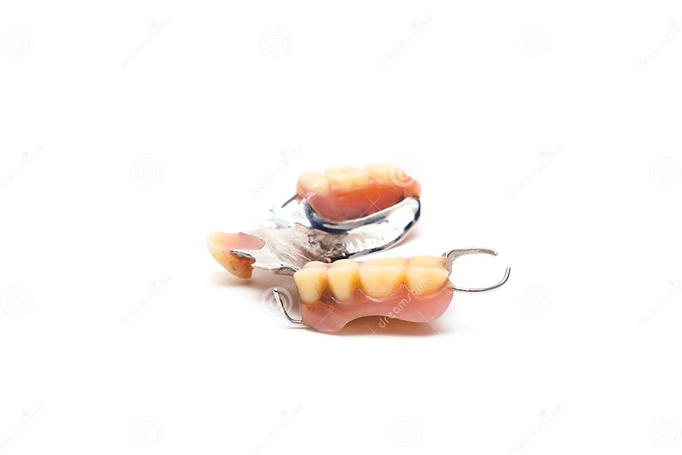 Stainless steal denture stock photo. Image of mouth, dental - 86715388