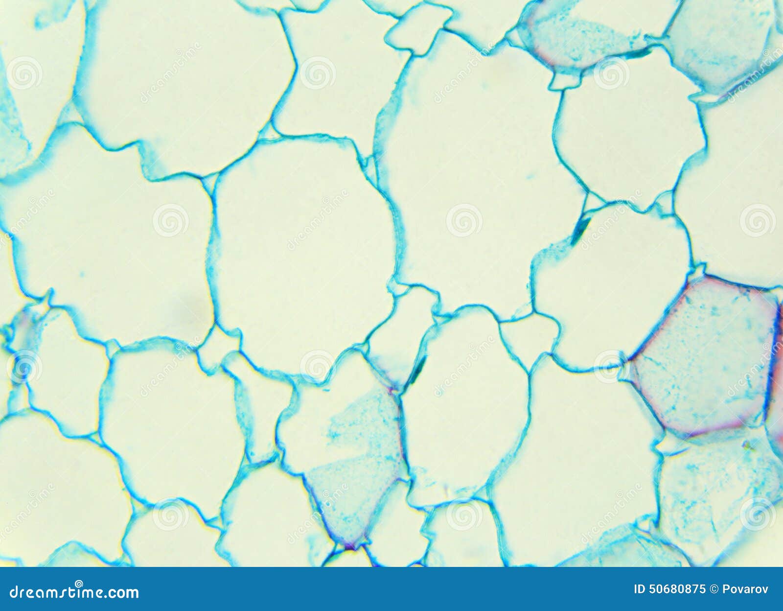 Stalk Of A Cereal Cross-section Under The Microscope (Corn Stem Royalty ...
