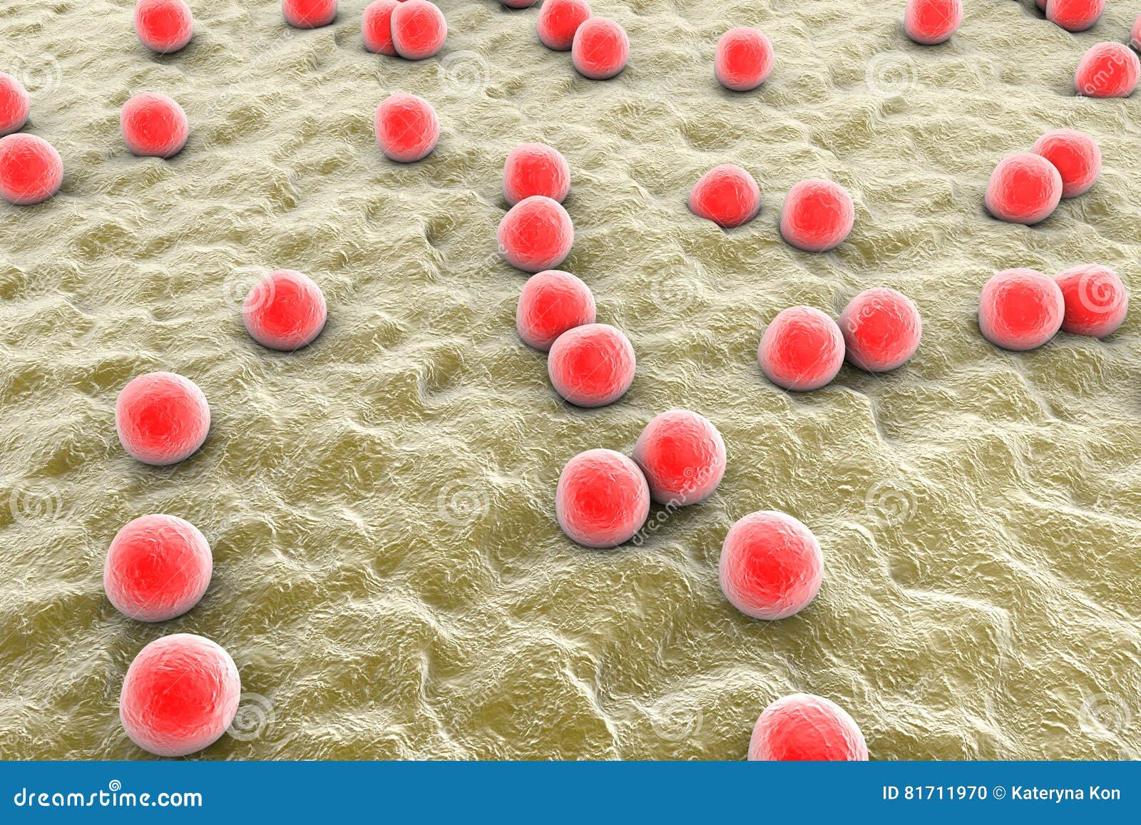 Staphylococci on the Surface of Skin Stock Illustration - Illustration ...