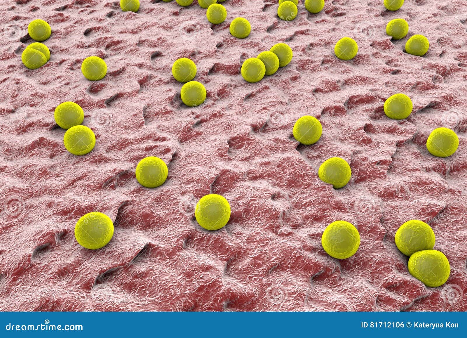 Staphylococci on the Surface of Skin Stock Illustration - Illustration ...