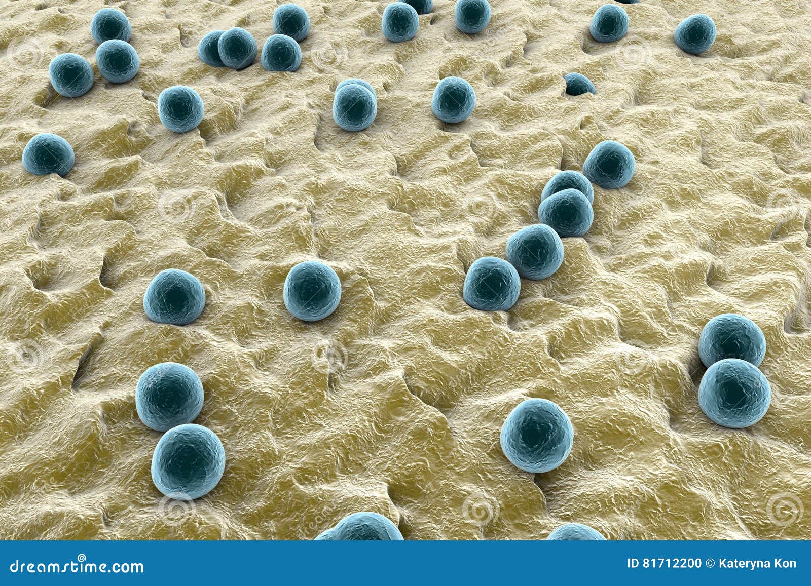 Staphylococci on the Surface of Skin Stock Illustration - Illustration ...