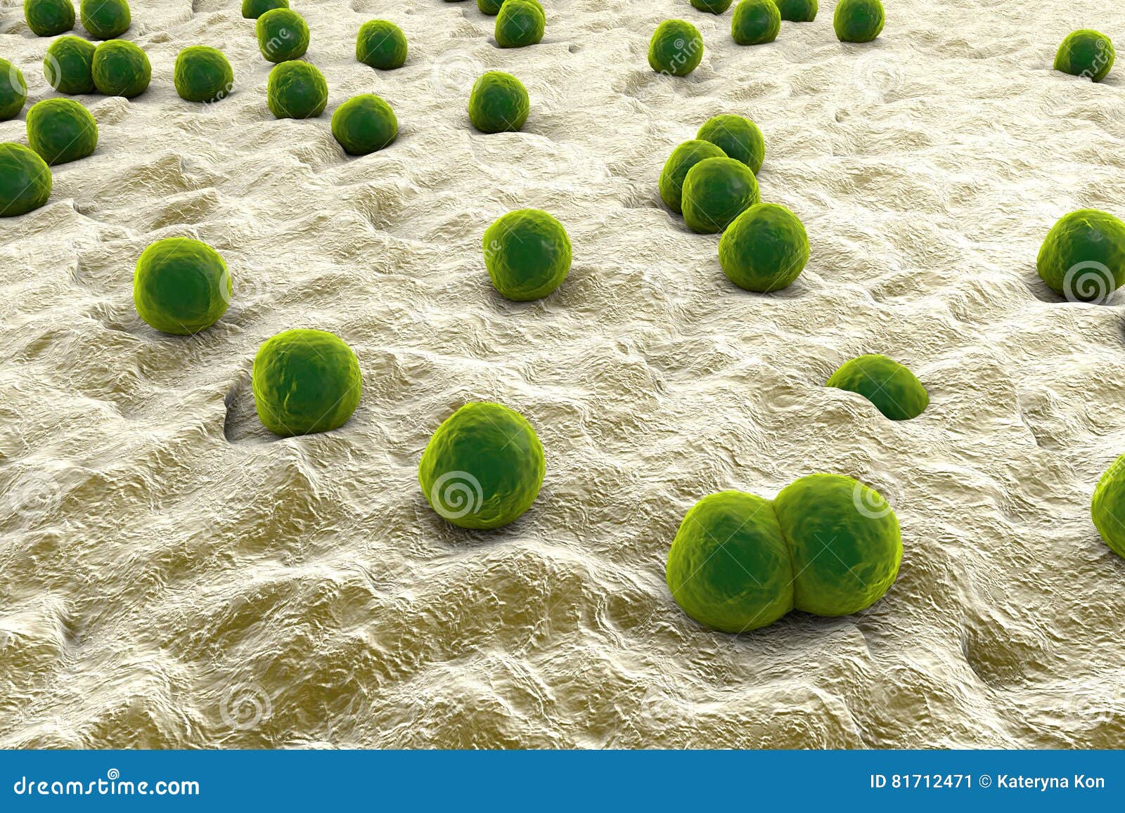 Staphylococci on the Surface of Skin Stock Illustration - Illustration ...