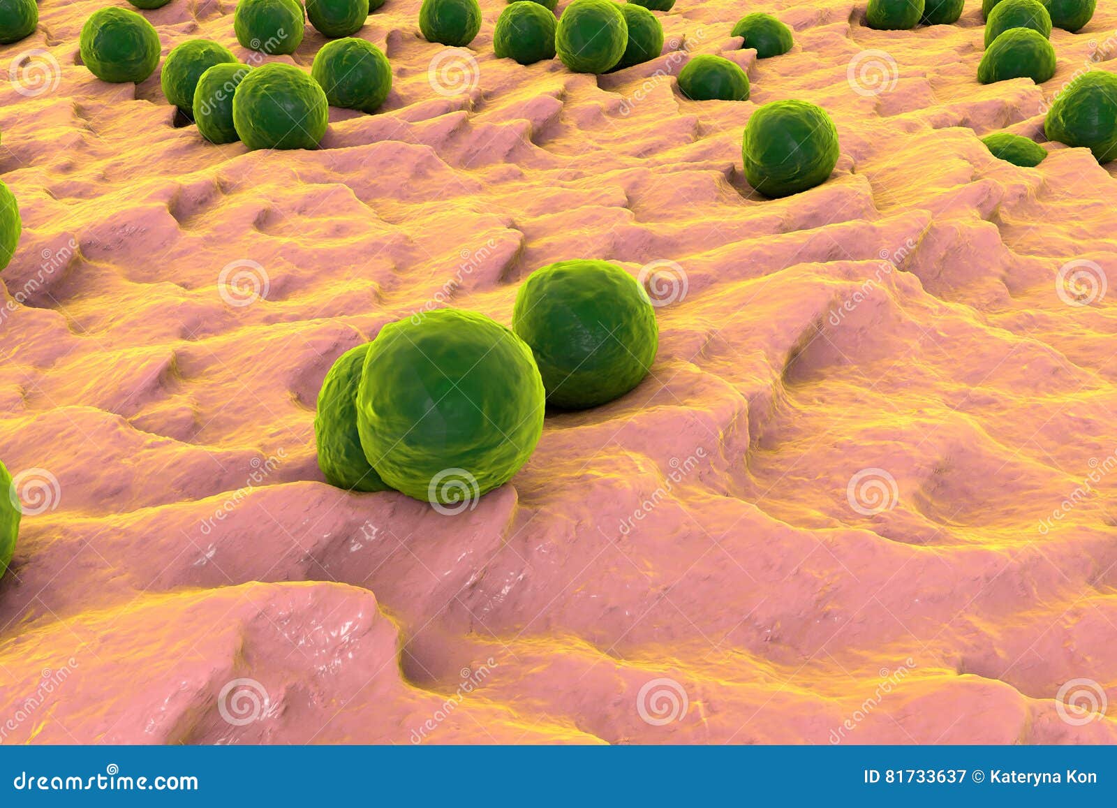 Staphylococci on the Surface of Skin Stock Illustration - Illustration ...