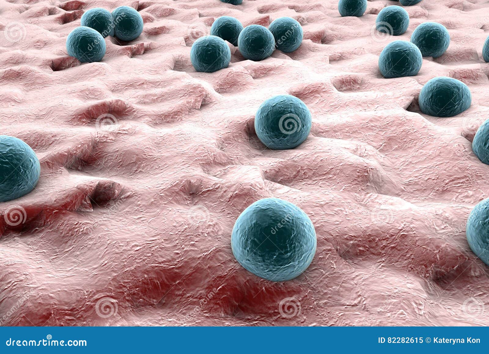 Staphylococci on the Surface of Skin Stock Illustration - Illustration ...
