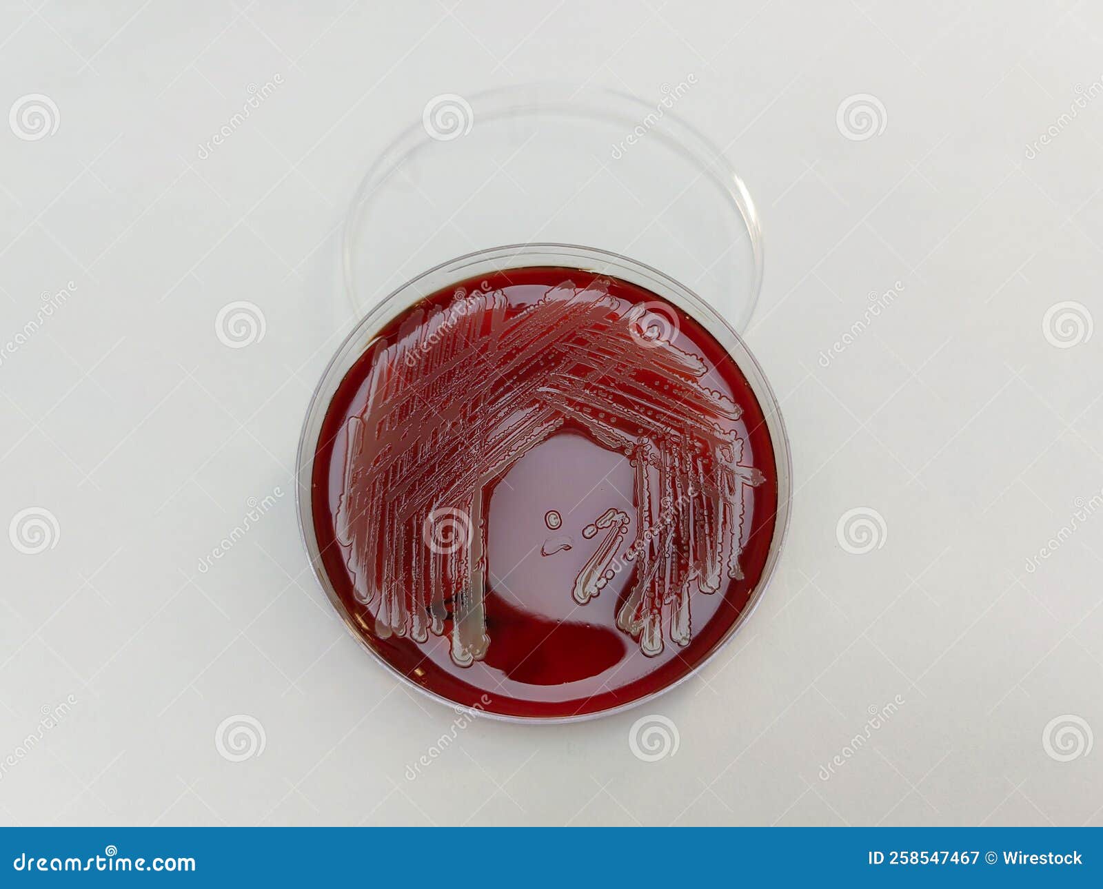 Staphylococcus Aureus Bacteria Displayed on Blood Agar Plate on a White ...