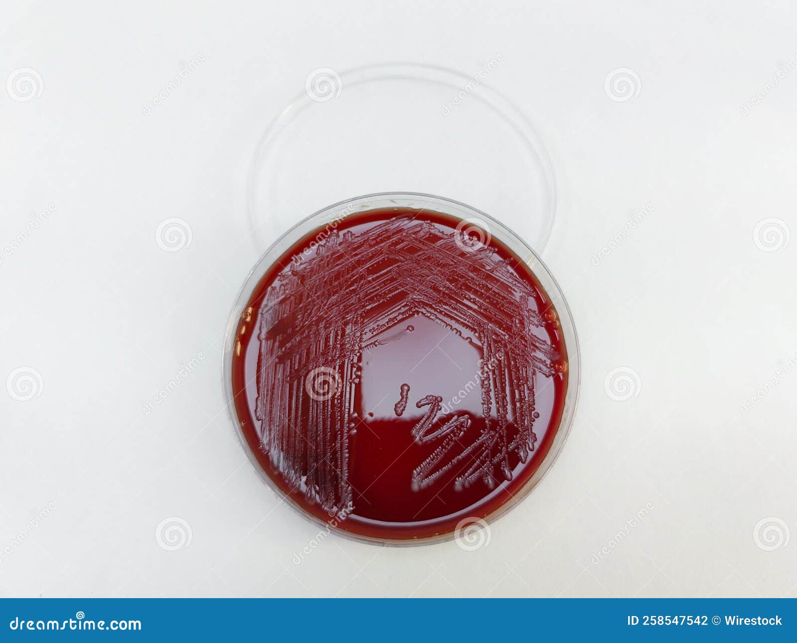 Staphylococcus Aureus Bacteria Displayed on a Blood Agar Plate on White ...