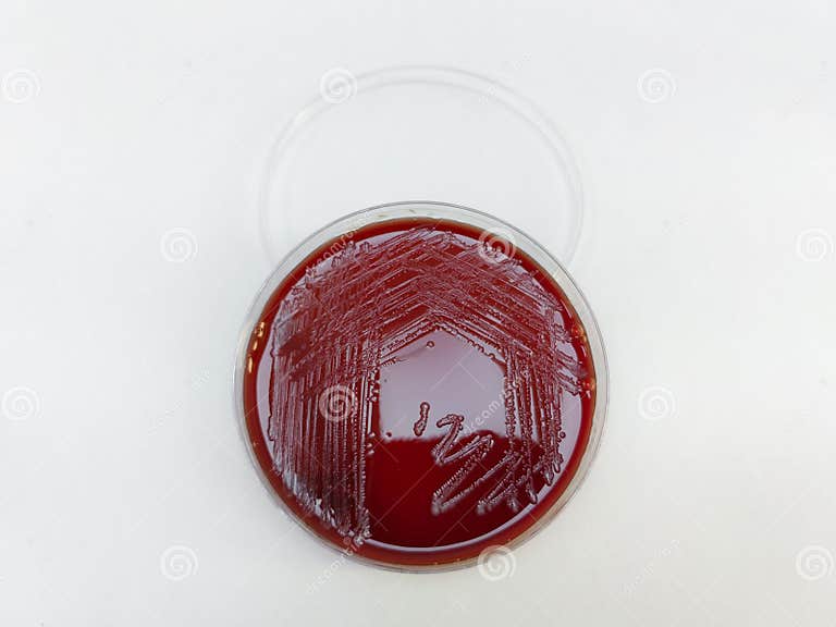 Staphylococcus Aureus Bacteria Displayed on a Blood Agar Plate on White ...