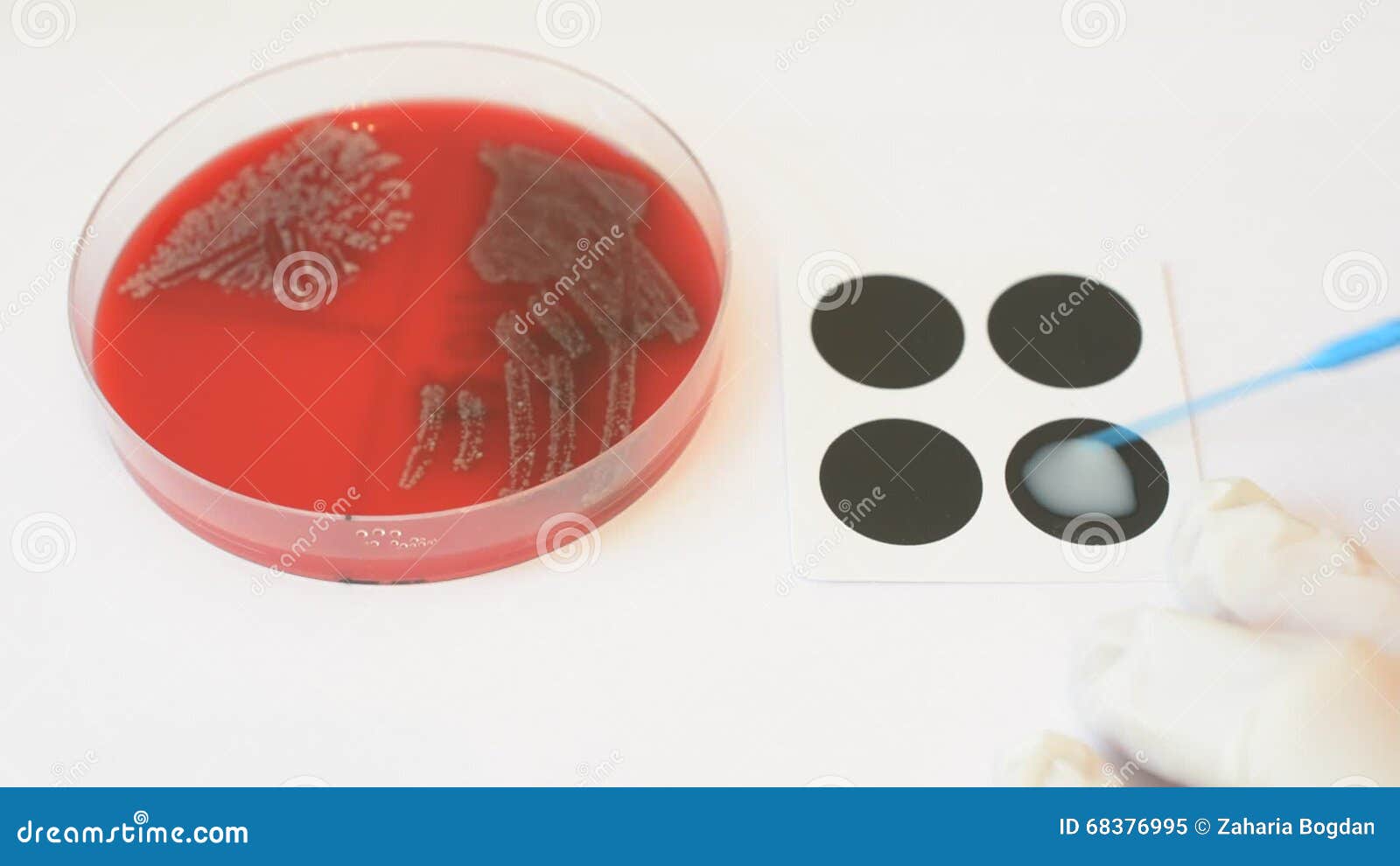 Staphylococcus Aureus Bacteria from Nasal Exudate Stock Video - Video ...