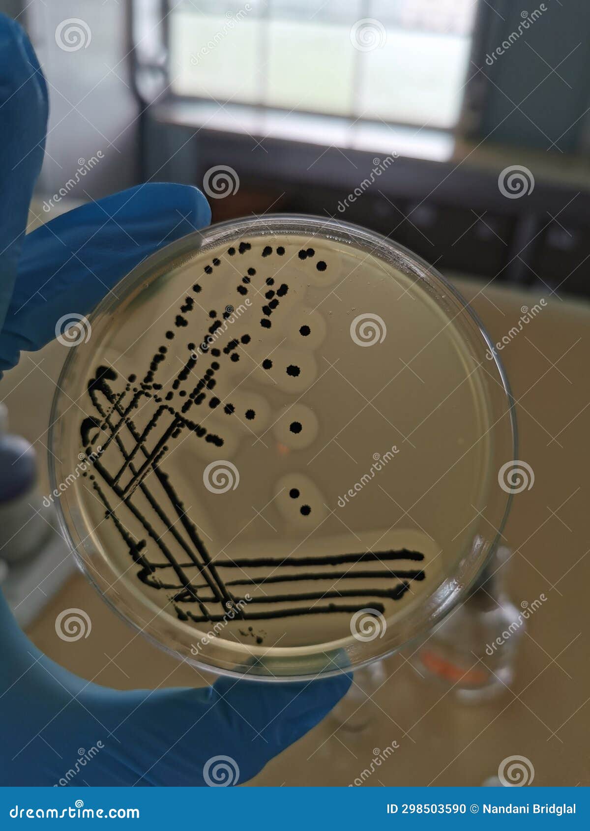Staphylococcus Aureus on Baird-Parker Agar Stock Photo - Image of ... Staphylococcus Aureus on Baird-Parker Agar Stock Photo - Image of ...