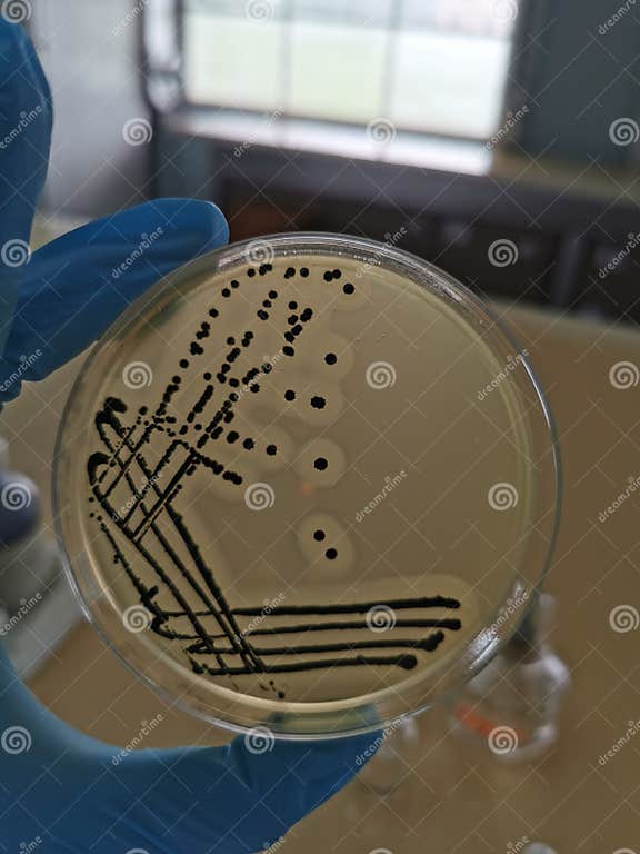 Staphylococcus Aureus on Baird-Parker Agar Stock Photo - Image of ...