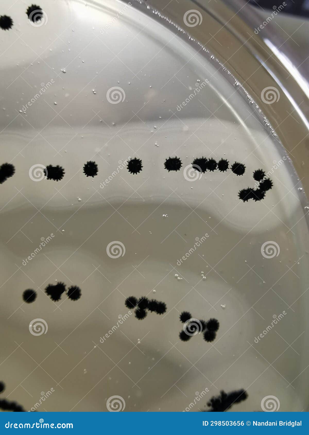 Staphylococcus Aureus on Baird-Parker Agar Stock Photo - Image of ... Staphylococcus Aureus on Baird-Parker Agar Stock Photo - Image of ...
