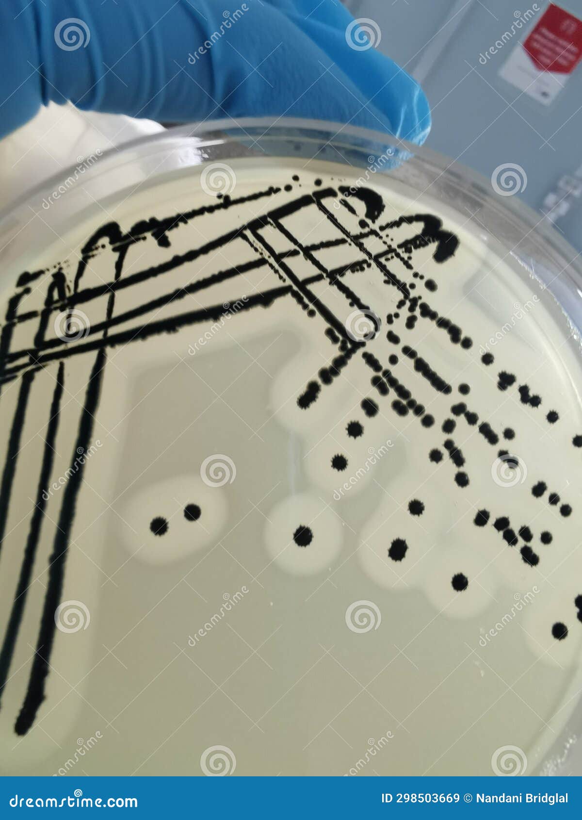 Staphylococcus Aureus on Baird-Parker Agar Stock Image - Image of ... Staphylococcus Aureus on Baird-Parker Agar Stock Image - Image of ...