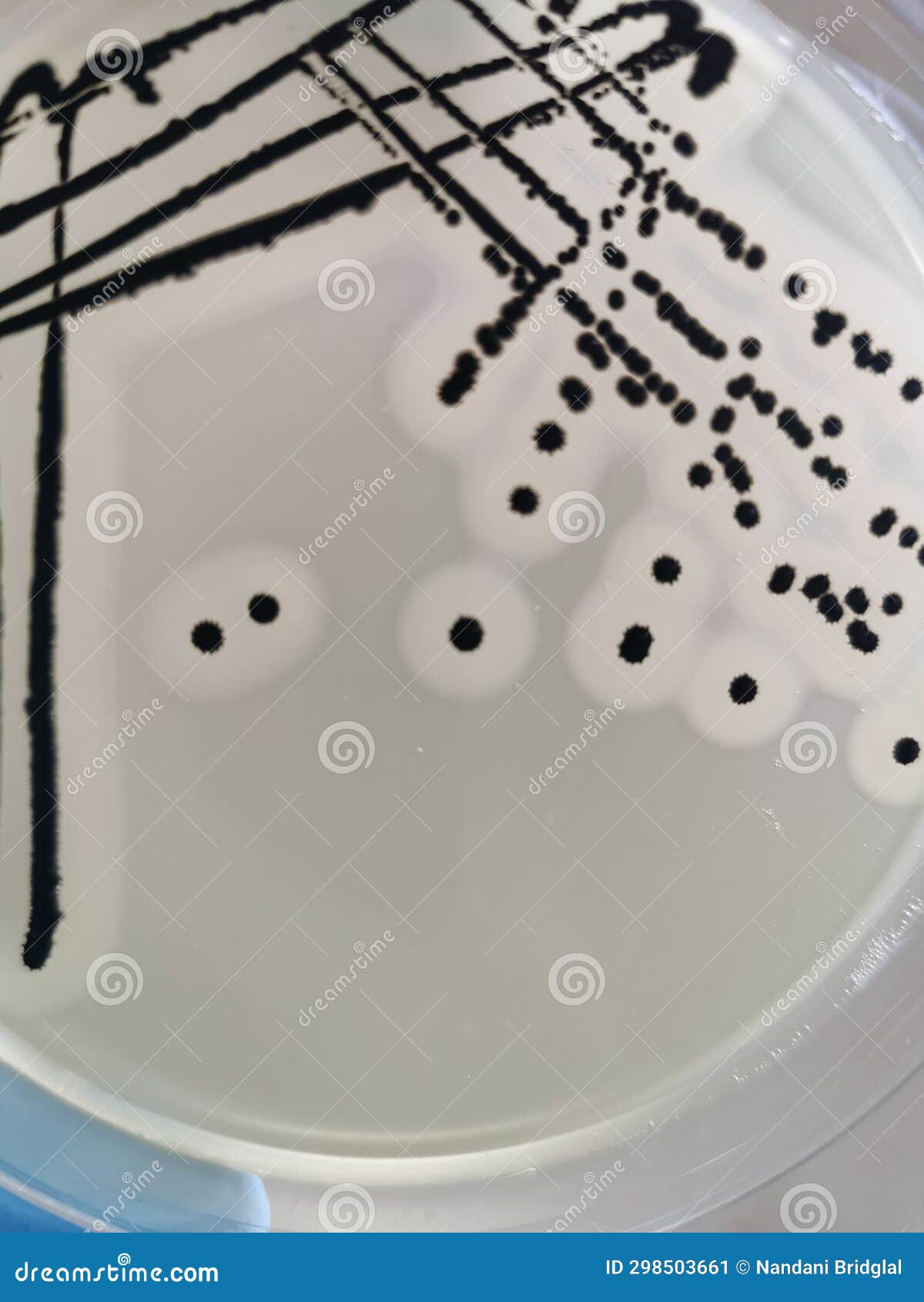 Staphylococcus Aureus On Baird-Parker Agar Stock Image | CartoonDealer ... Staphylococcus Aureus On Baird-Parker Agar Stock Image | CartoonDealer ...