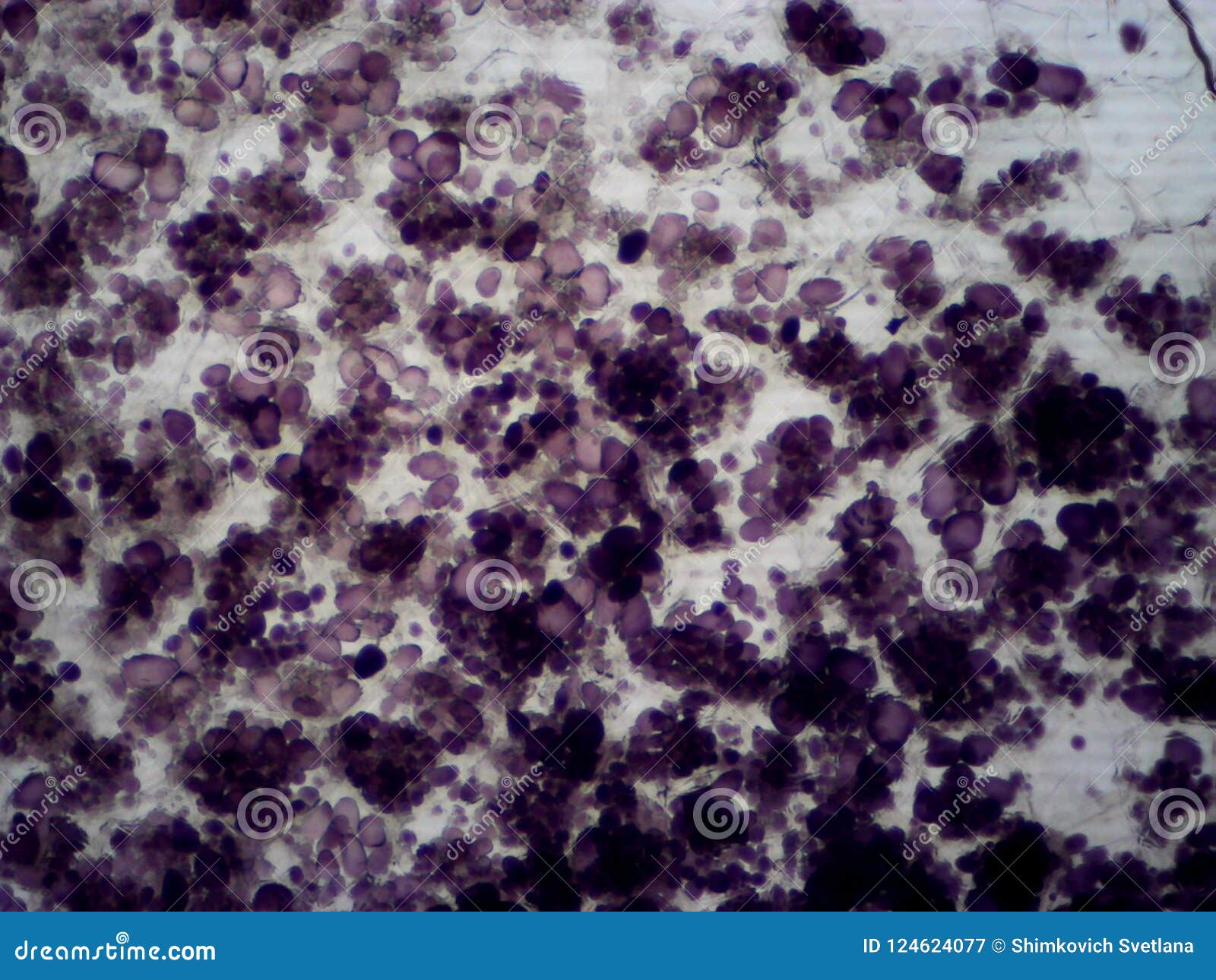 Potato Cells With Iodine