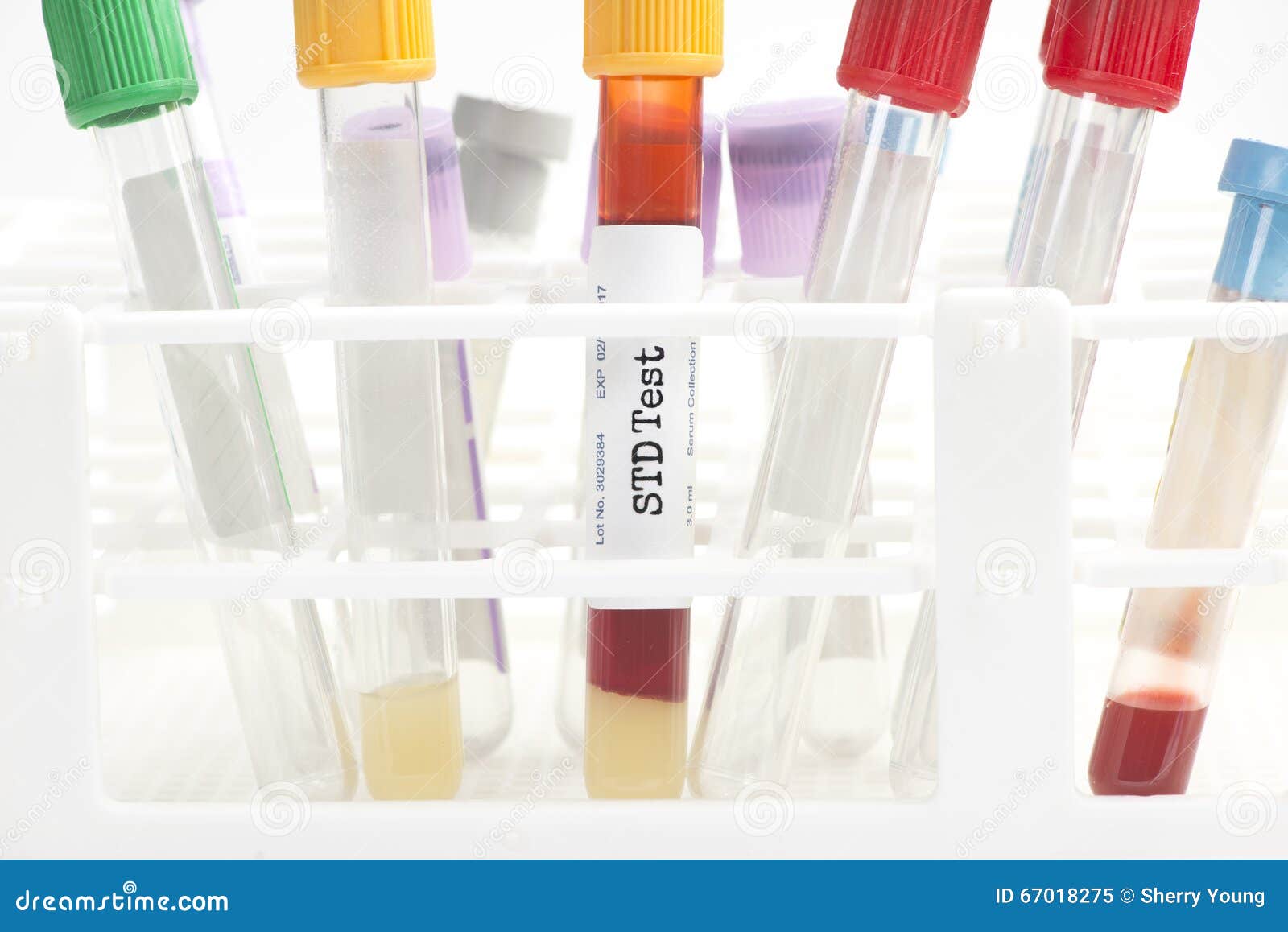 STD Testing stock image. Image of sample, research, test - 67018275