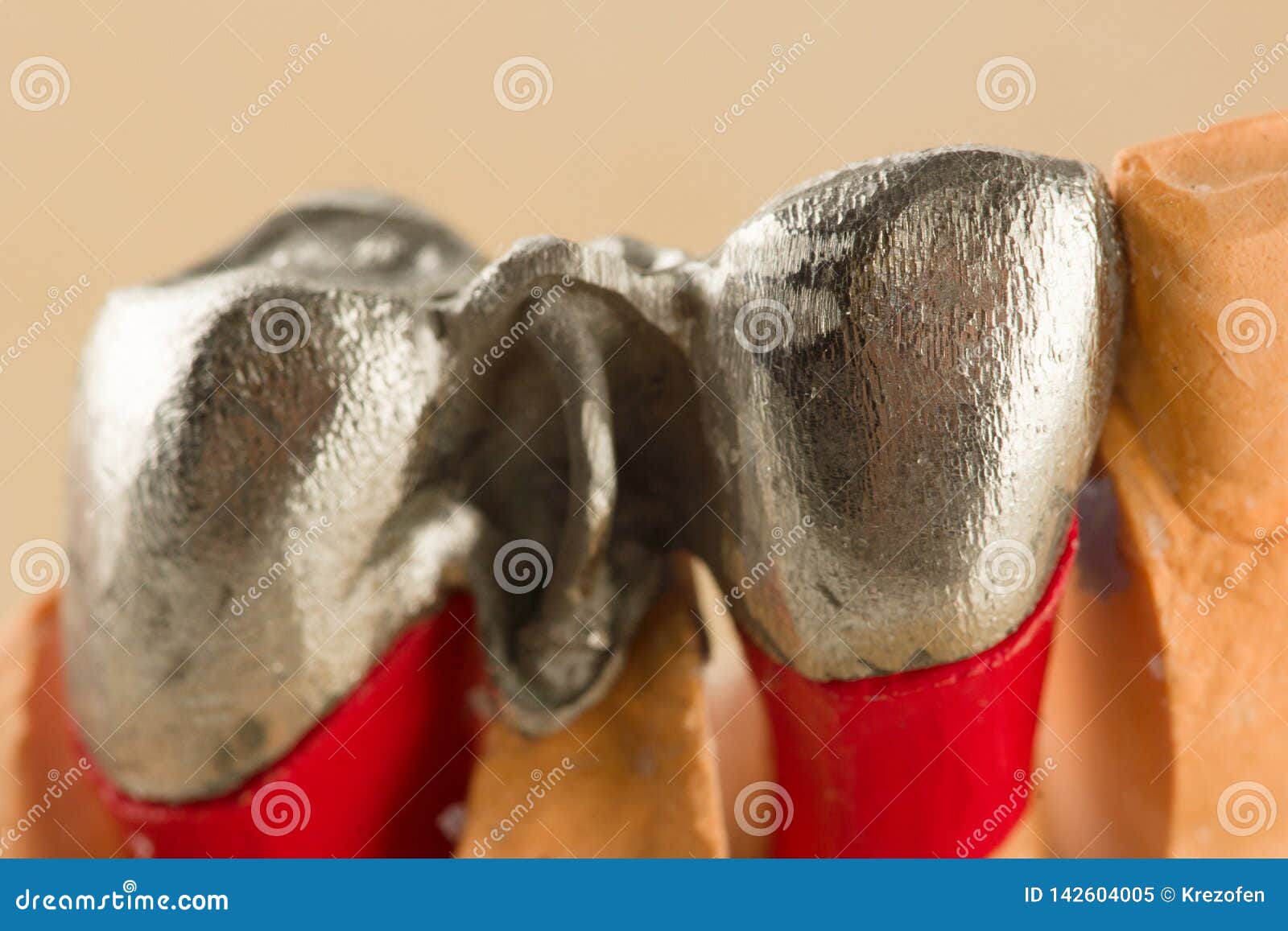 Steel Artificial Dental Crown for Dentition Restoration Stock Image ...
