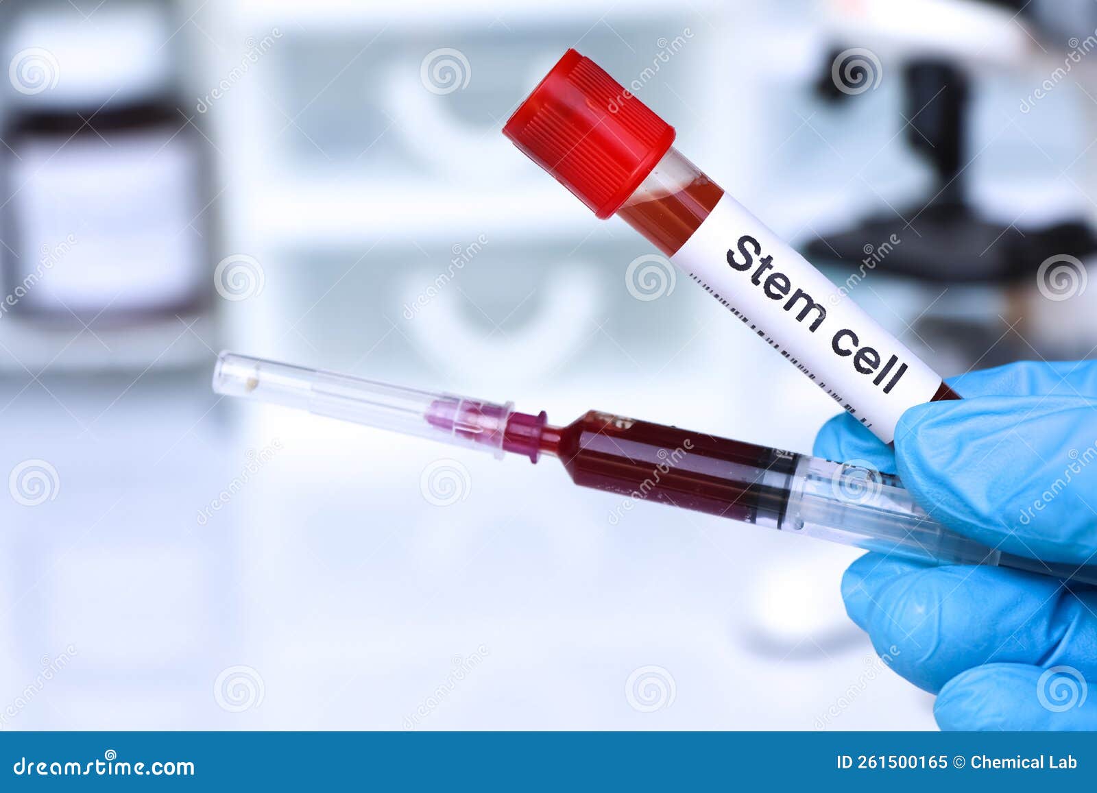 Stem Cell Test To Look for Abnormalities from Blood Stock Image - Image ...
