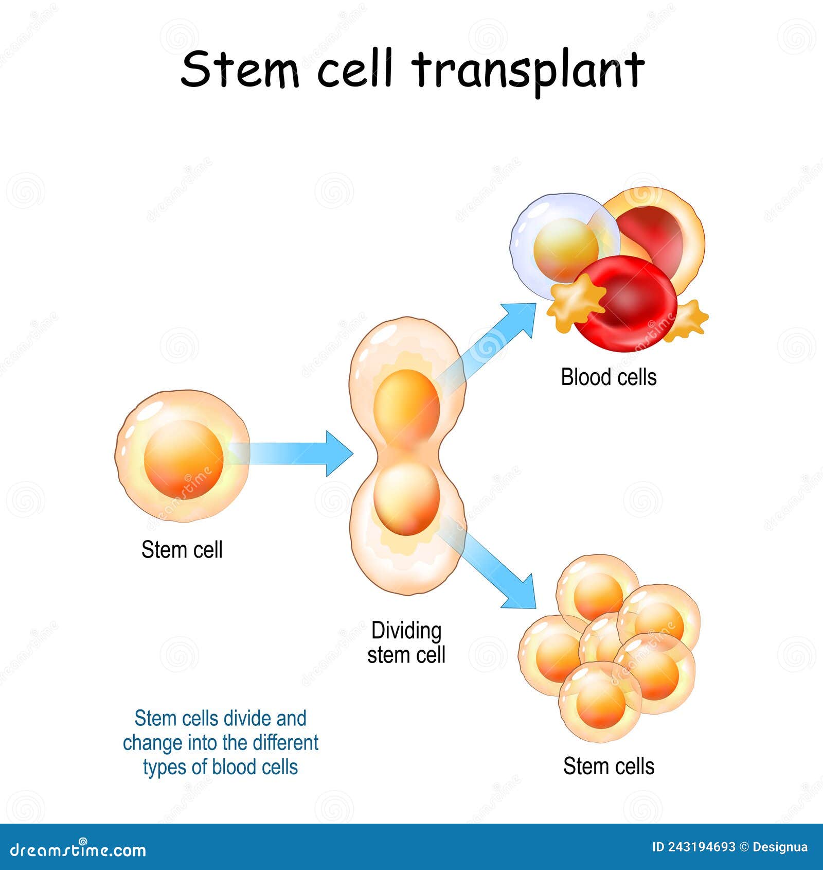 Stem cell transplant stock vector. Illustration of liver - 243194693