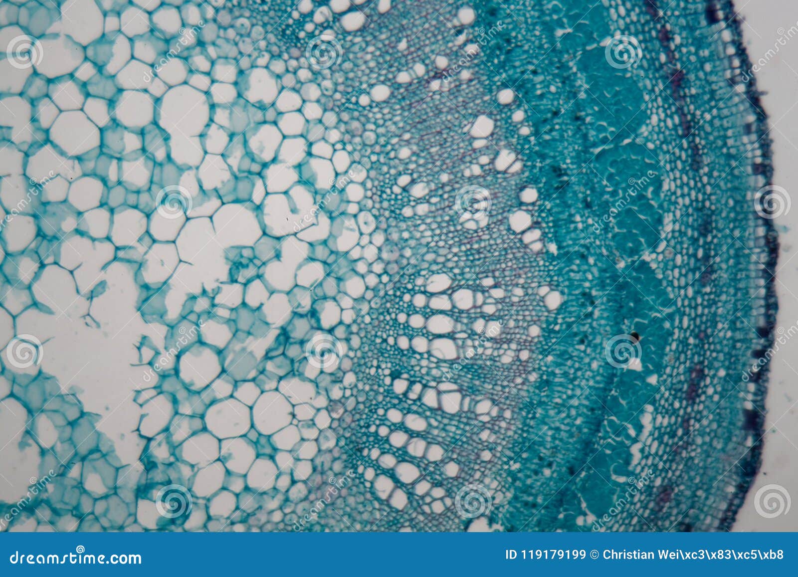 Stem Cells of a Lentil Plant Under the Microscope. Stock Image - Image ...