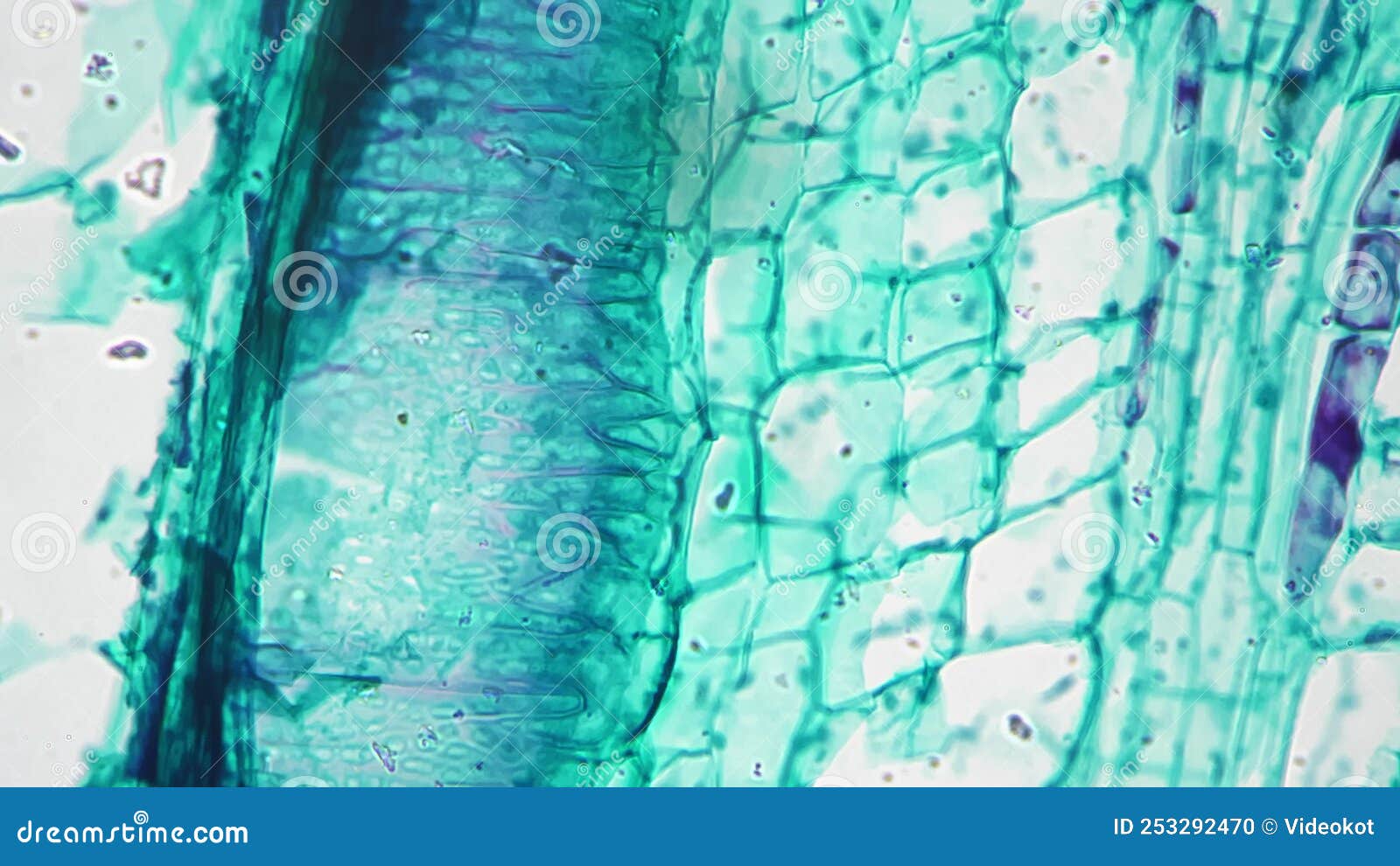 Stem of Cucurbita Moschata Under Microscope 400x Against Bright Field ...