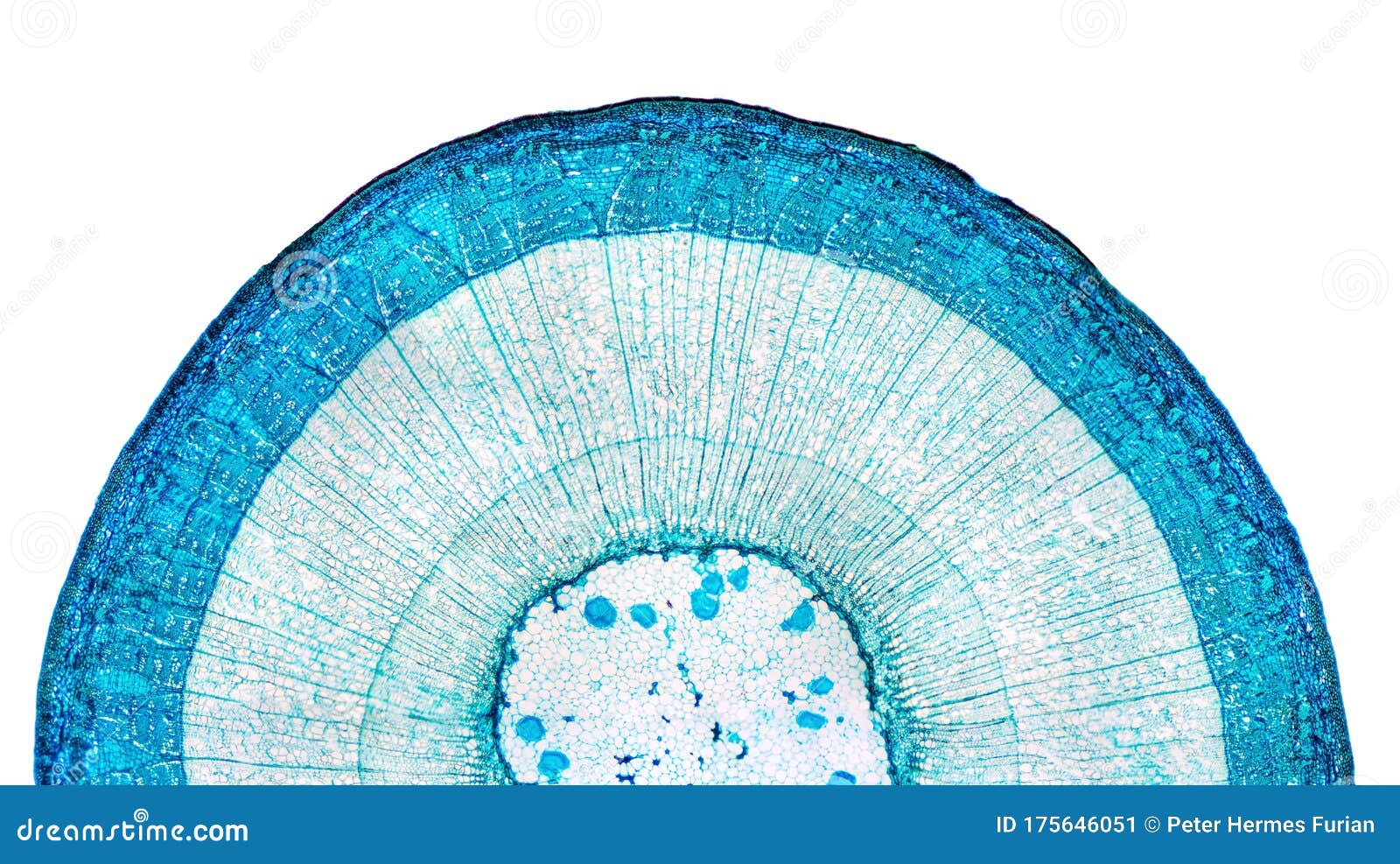 Stem Of Wood Dicotyledon, Half Cross Section Under Microscope Royalty ...