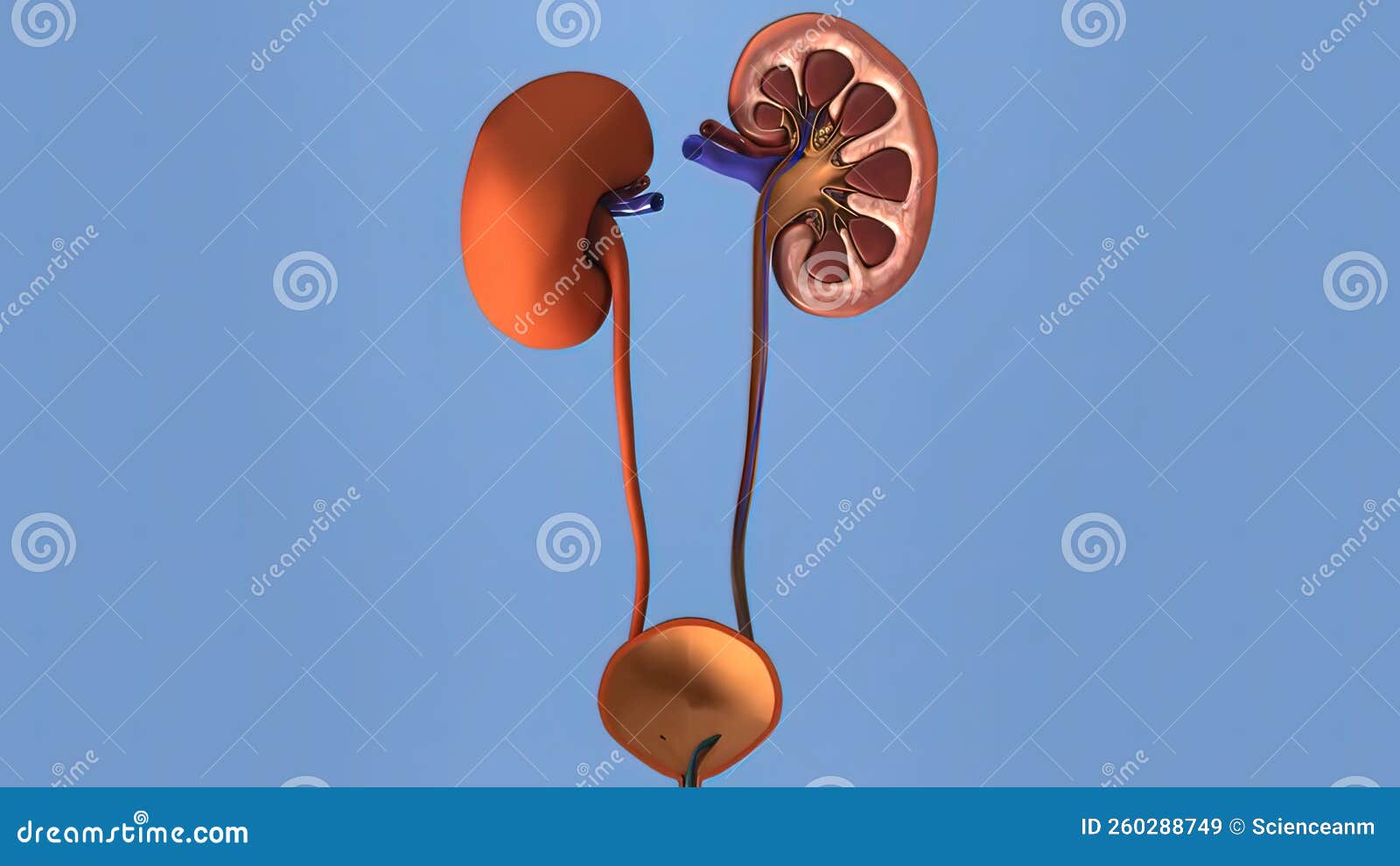 Stend Insertion between the Urinary Tract and Kidney Stock Illustration ...