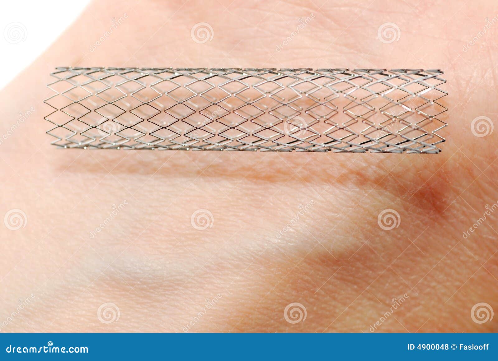 A stent stock photo. Image of protection, atheriosclerosis - 4900048