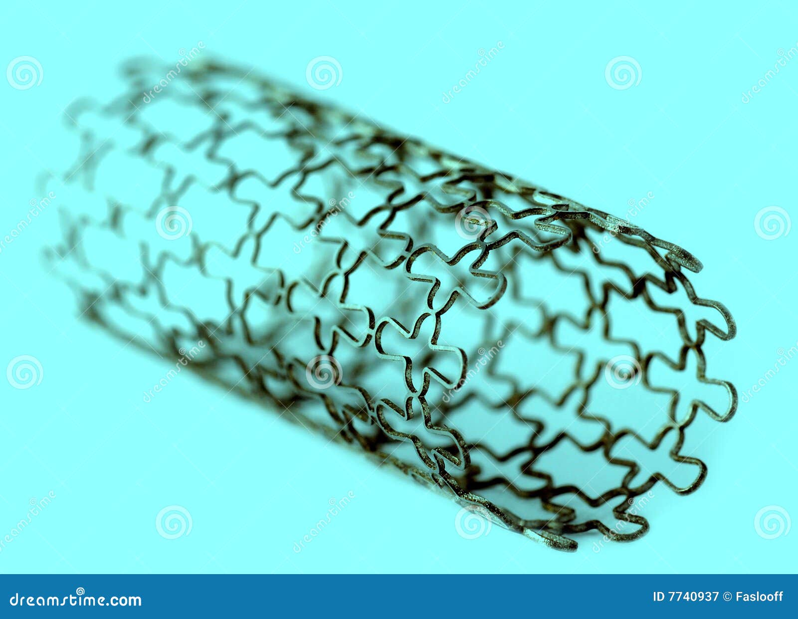 Stent stock image. Image of atheriosclerosis, illness - 7740937