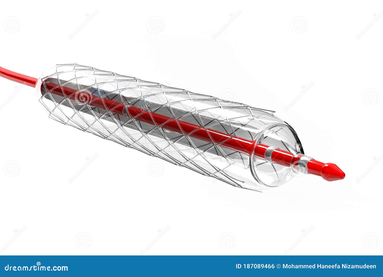 Stent For Balloon Angioplasty Stock Photography | CartoonDealer.com ...