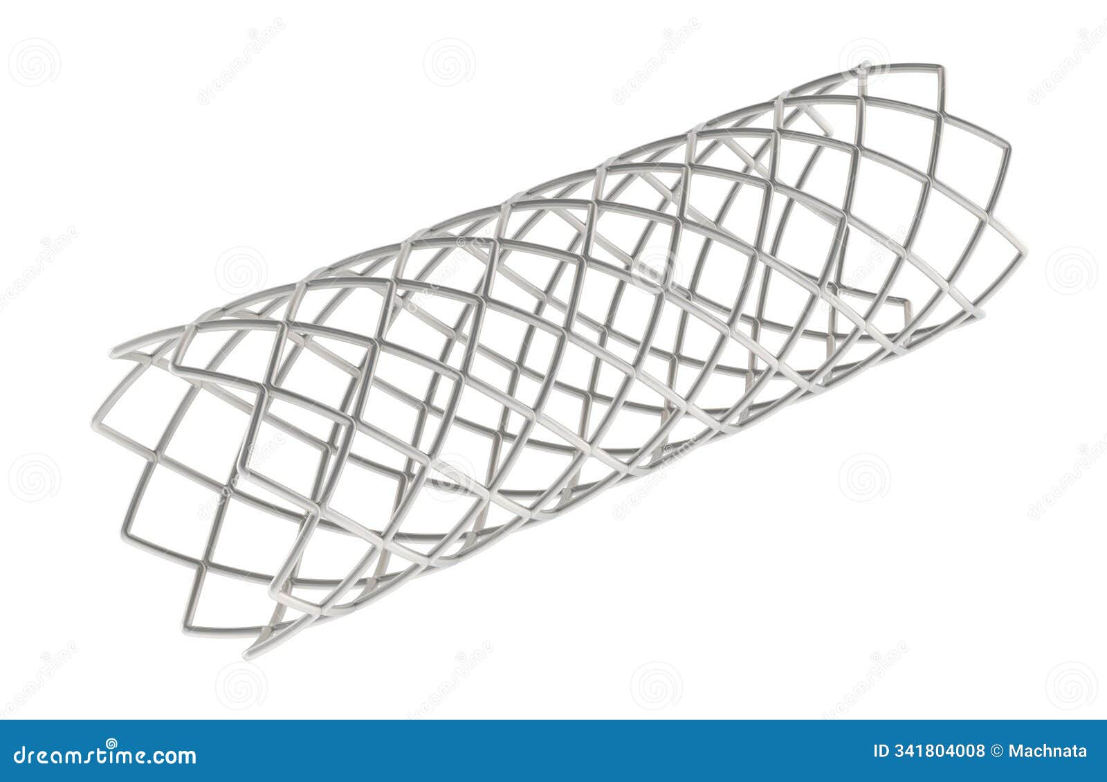 Ureteral Stent. Cross Section Of A Kidney And Bladder With Pig-tail ...
