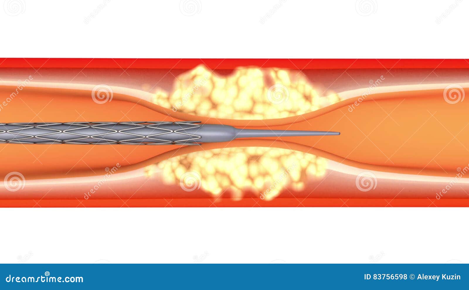 Tissue Animation Stock Footage & Videos - 2,424 Stock Videos