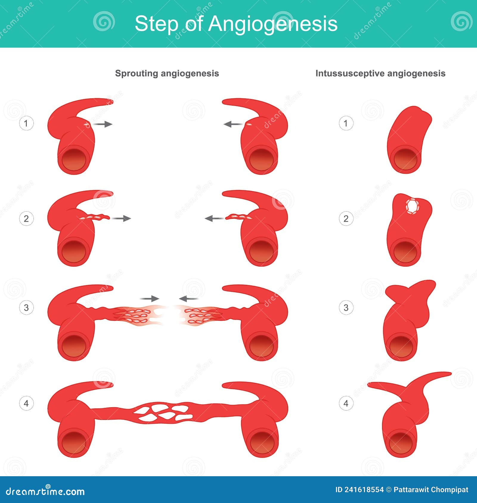 Angiogenesis Of Blood Vessels In Tumor Cartoon Vector | CartoonDealer ...