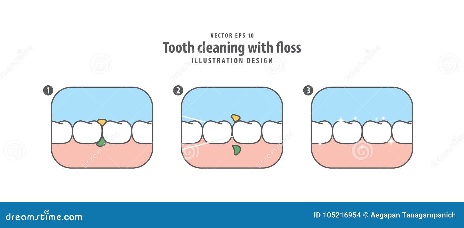 Step Of Tooth Decay Formation. Cartoon Vector | CartoonDealer.com ...