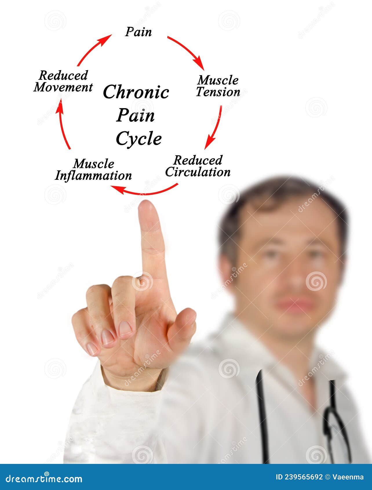 Chronic Pain Cycle stock photo. Image of tension, medical - 239565692