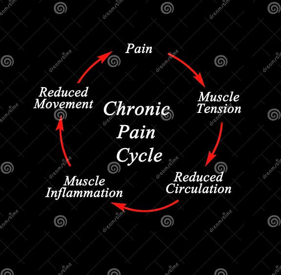 Chronic Pain Cycle stock illustration. Illustration of pain - 239565704