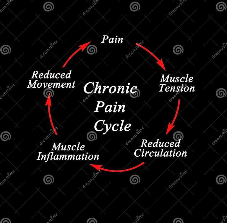 Chronic Pain Cycle stock illustration. Illustration of pain - 239565704