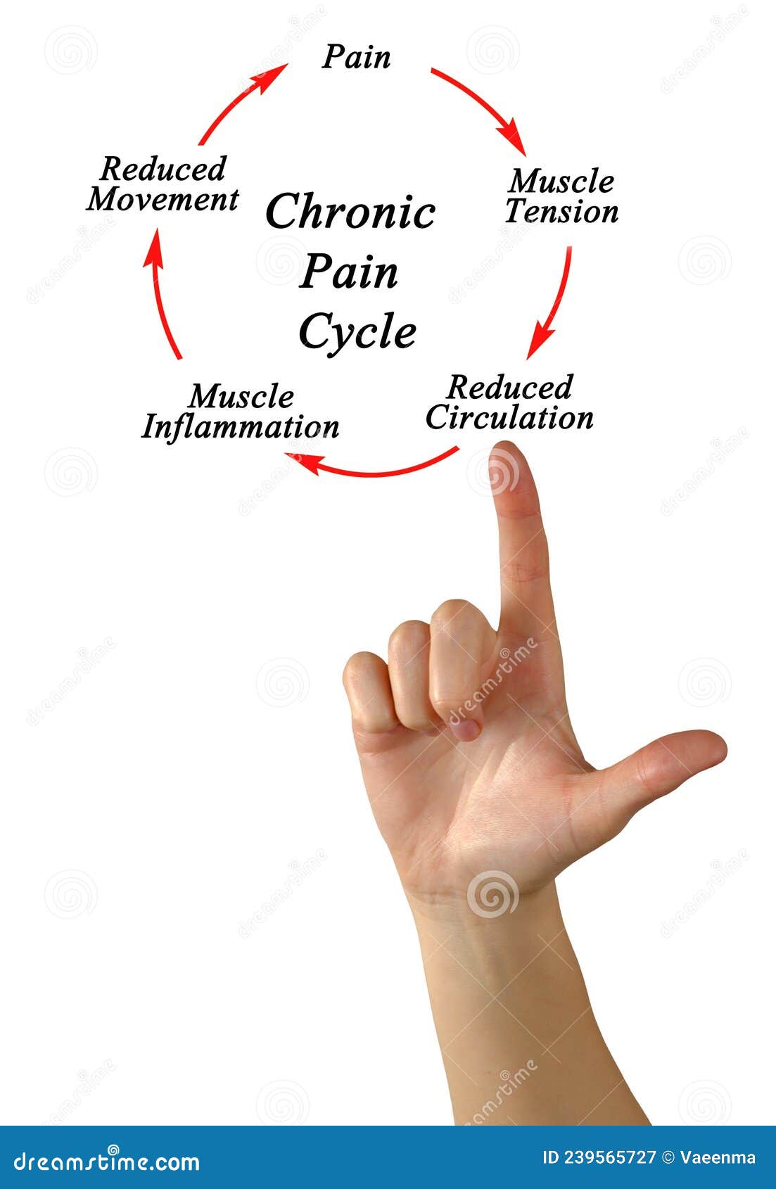 Chronic Pain Cycle stock image. Image of 1791, movement - 239565727