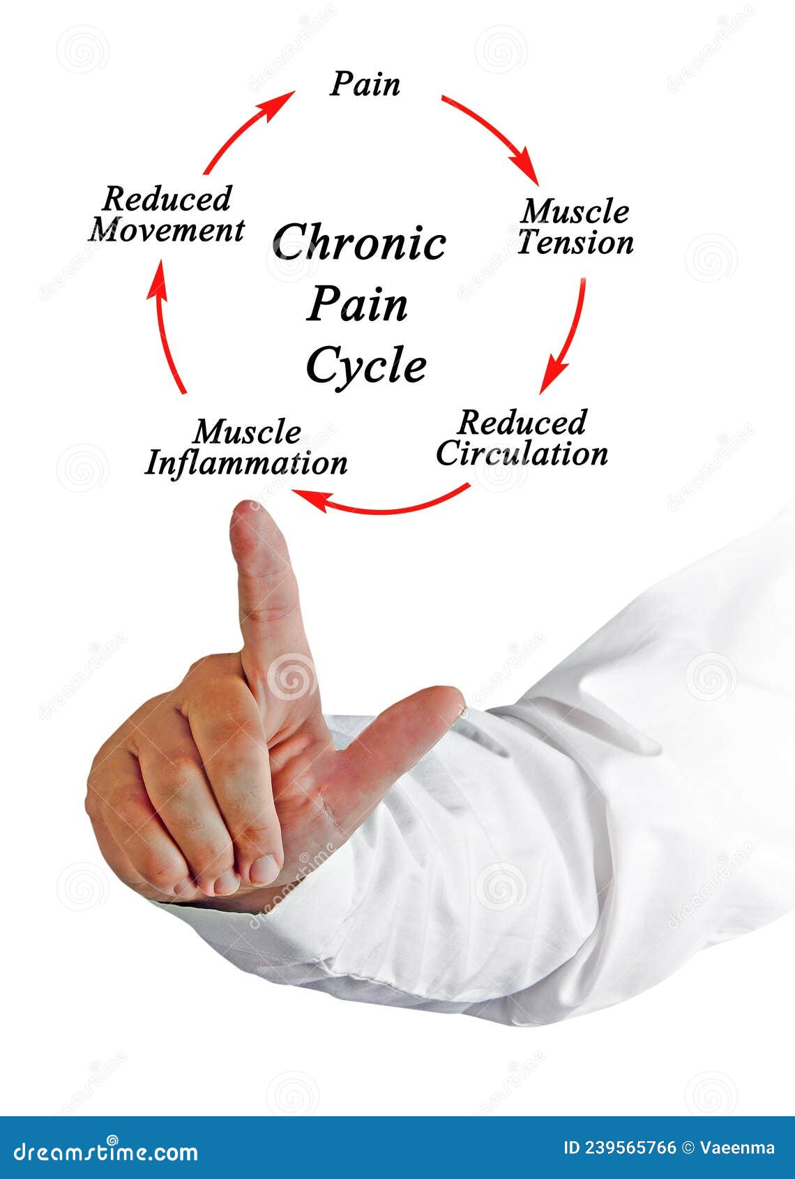 Chronic Pain Cycle stock photo. Image of movement, inflammation - 239565766