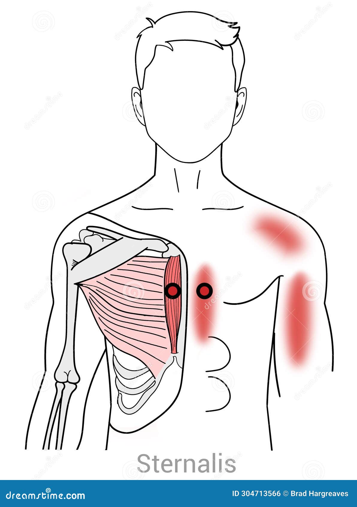 Sternalis stock illustration. Illustration of medical - 304713566