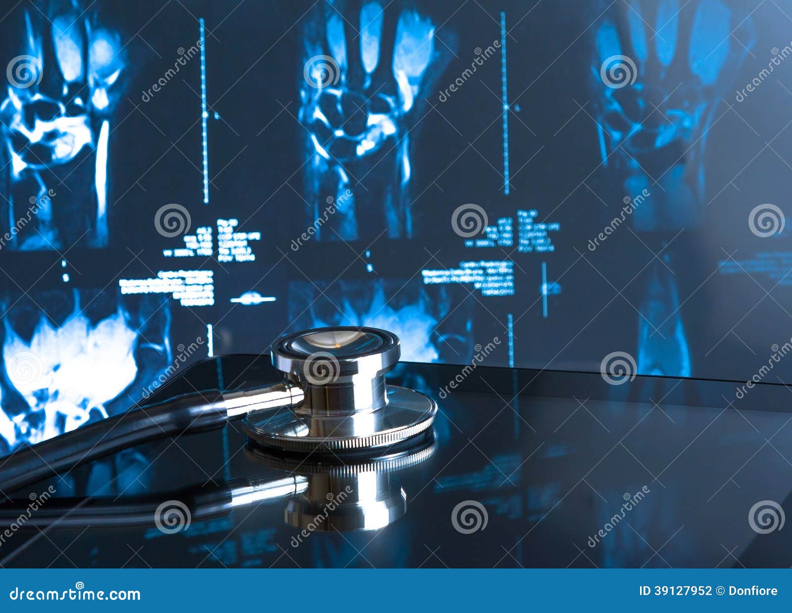 Stethoscoop Op Digitale Tabletpc Op X-ray Beelden Stock Foto - Image of ...