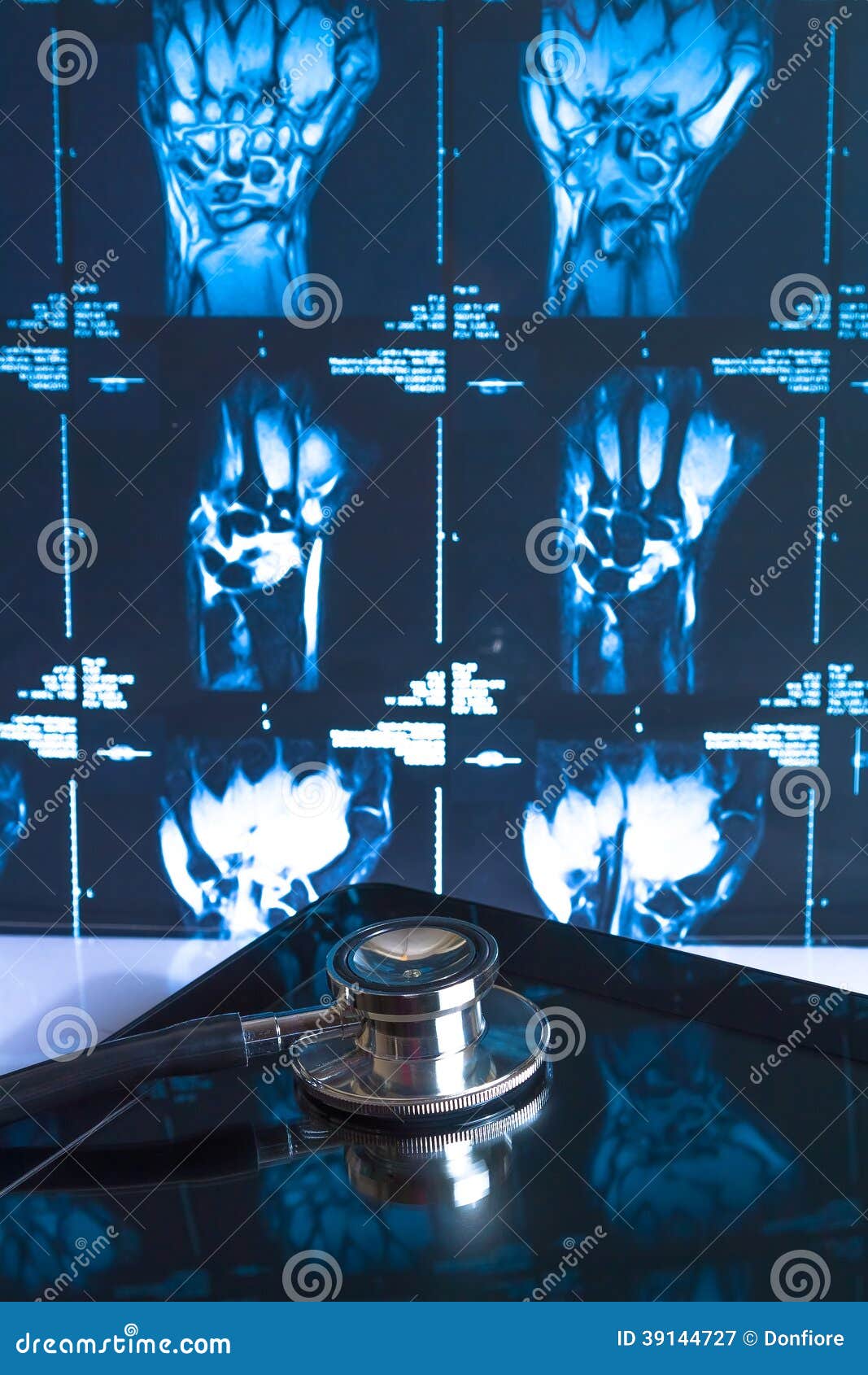 Stethoscoop Op Digitale Tabletpc Op X-ray Beelden Stock Afbeelding ...