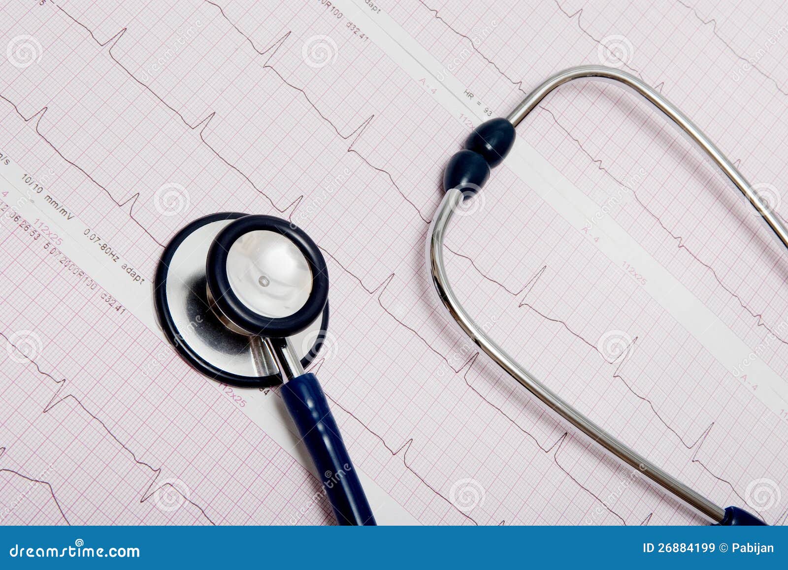 Stethoscoop Op Ecg- Grafiek Stock Afbeelding - Image of cardiologie ...