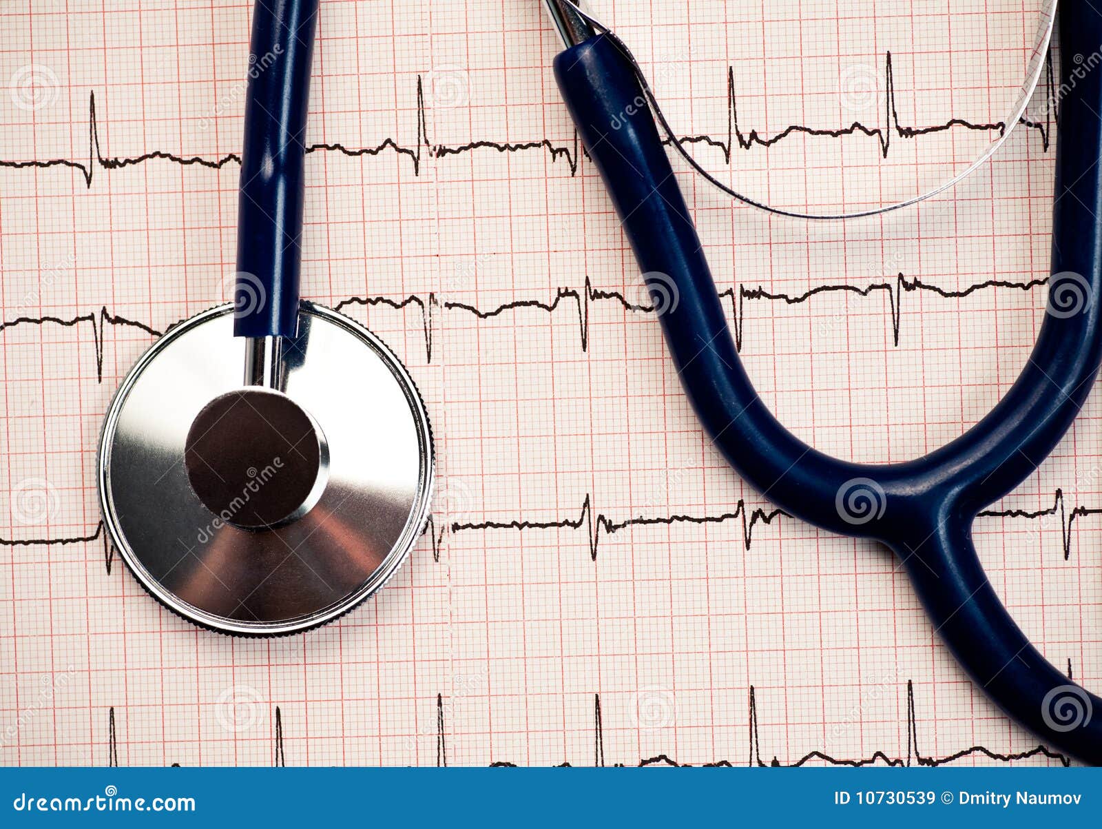 Stethoscoop Op Electrocardiogram Stock Afbeelding - Image of kardiogram ...