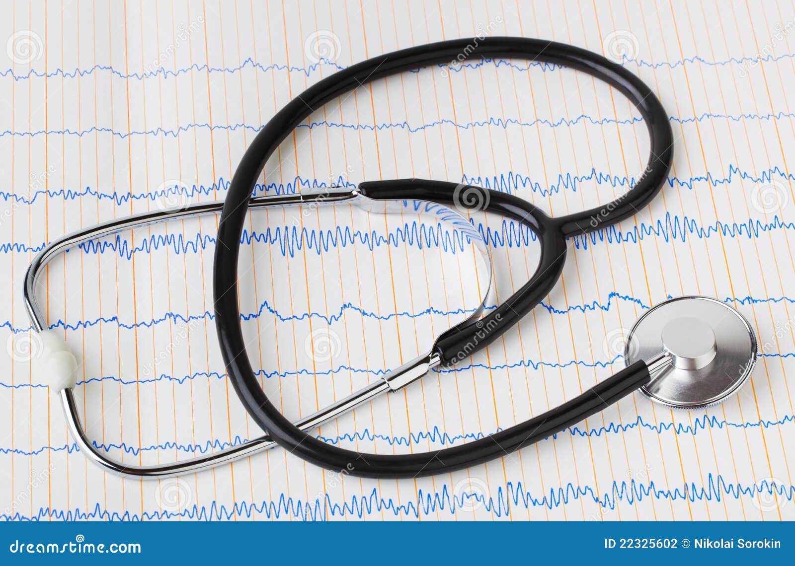 Stethoscope on ecg stock photo. Image of disease, line - 22325602