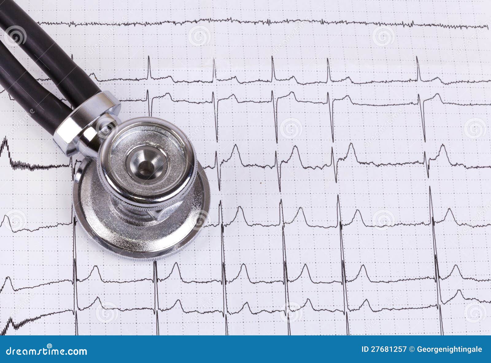 Stethoscope and ecg stock image. Image of analysis, cardiogram - 27681257