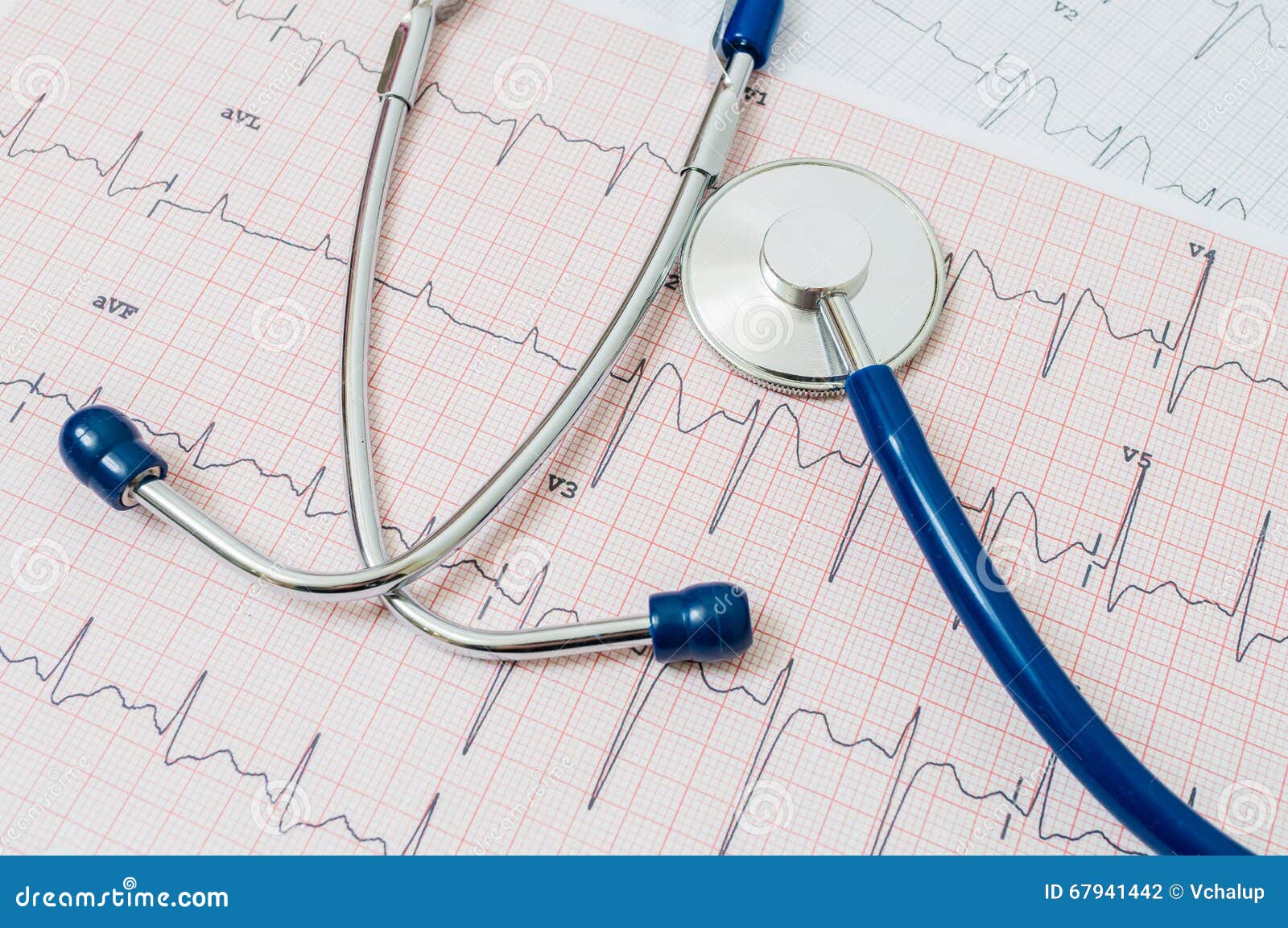Stethoscope on ECG (electrocardiogram) Chart Stock Photo - Image of ...