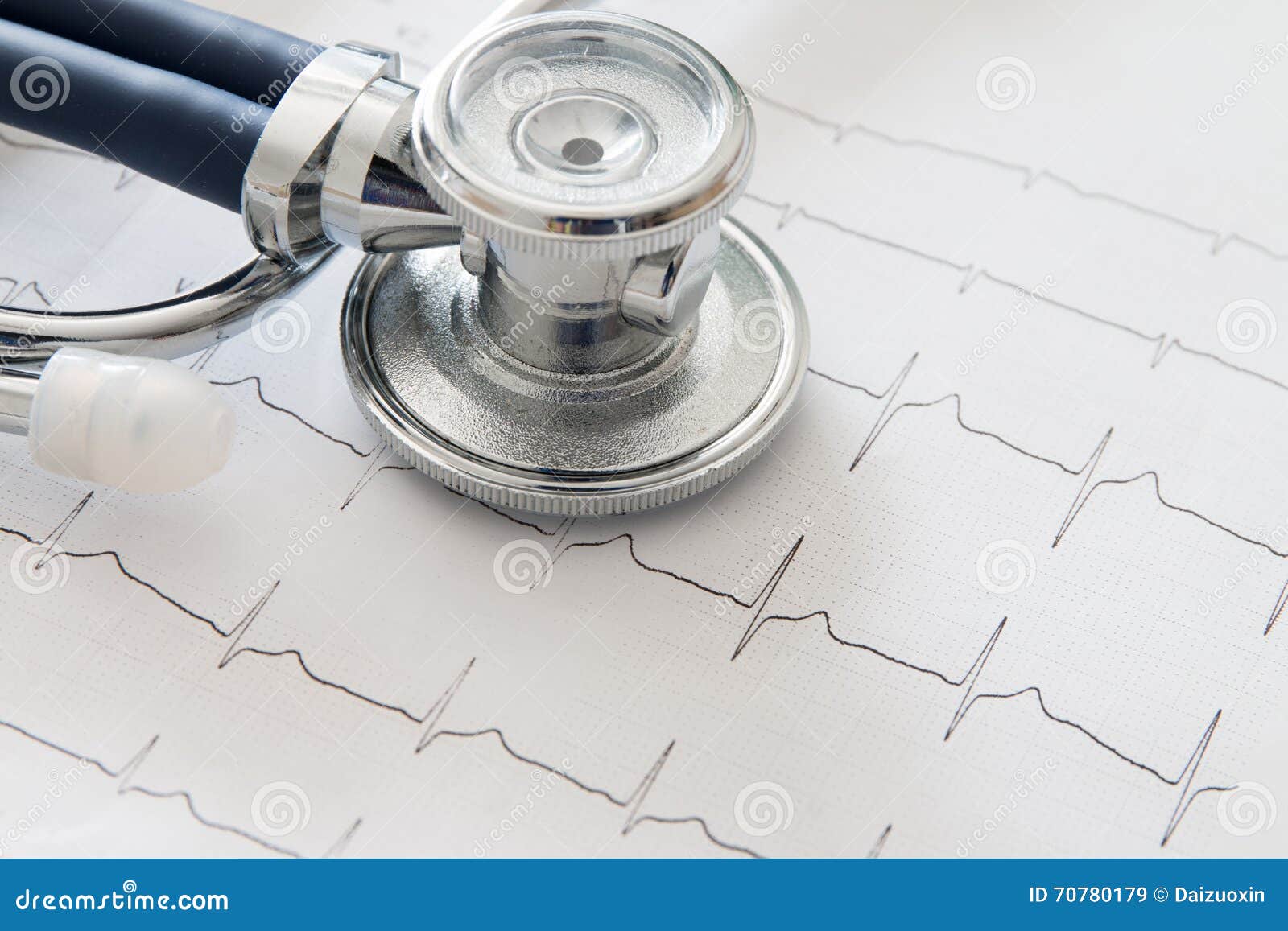 Electrocardiogram Chart Background Royalty-Free Stock Photo ...